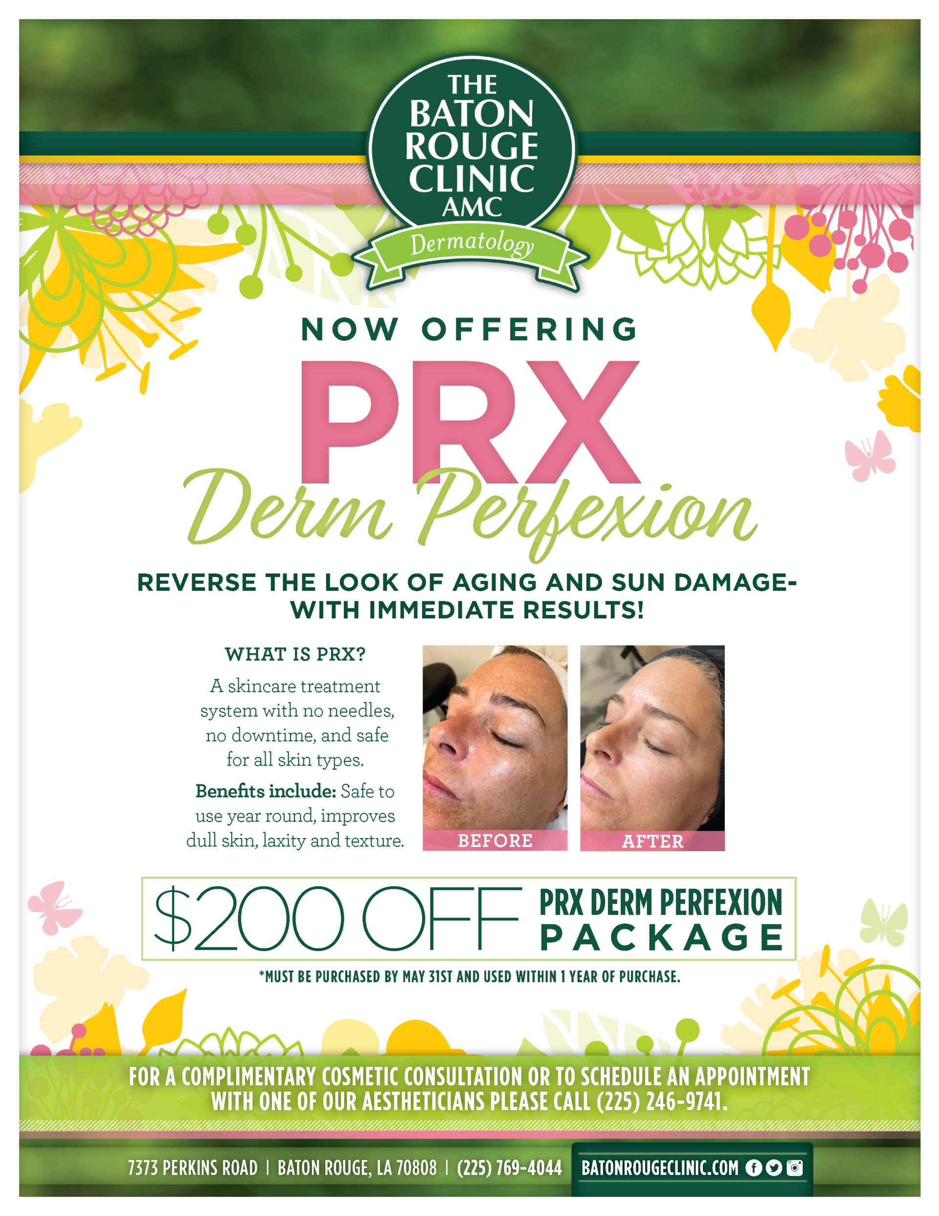 Now Offering: PRX Derm Perfexion - Baton Rouge Clinic